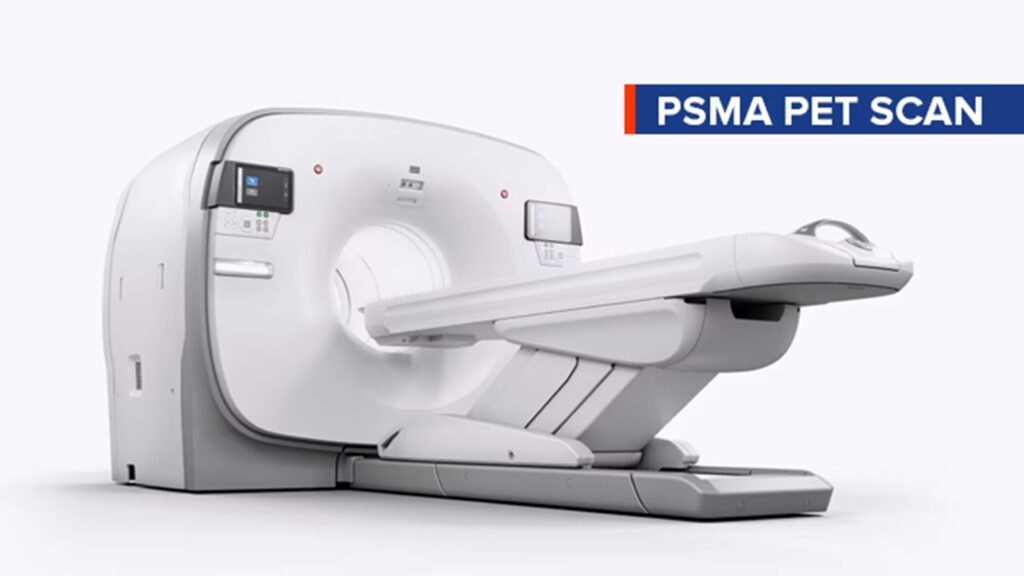 Descúbrelo en PSMA Pet Scan - Ce2s Parts and Services